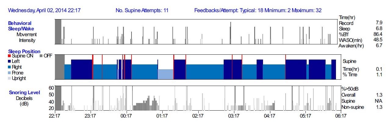 Night Shift Sleep Positioner for Positional Sleep Apnoea & Snoring - Hope2Sleep Charity