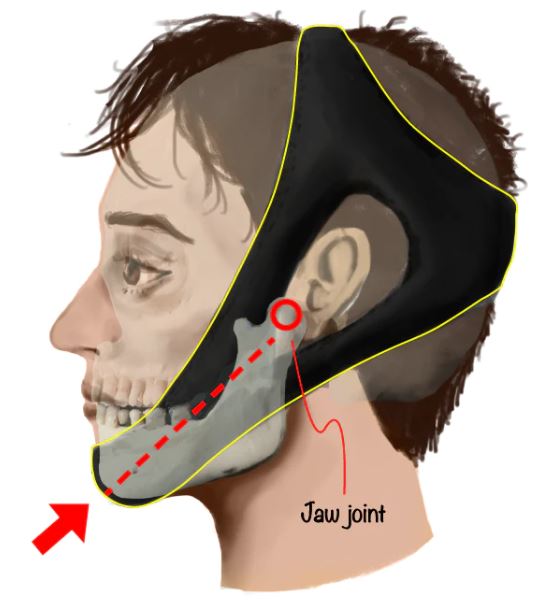 Dual Band Vertical Lift Anti Snore and CPAP Chinstrap - Hope2Sleep Charity